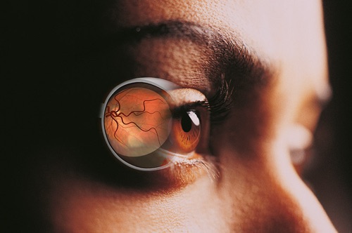 Eyecare - Eden Rise Optical